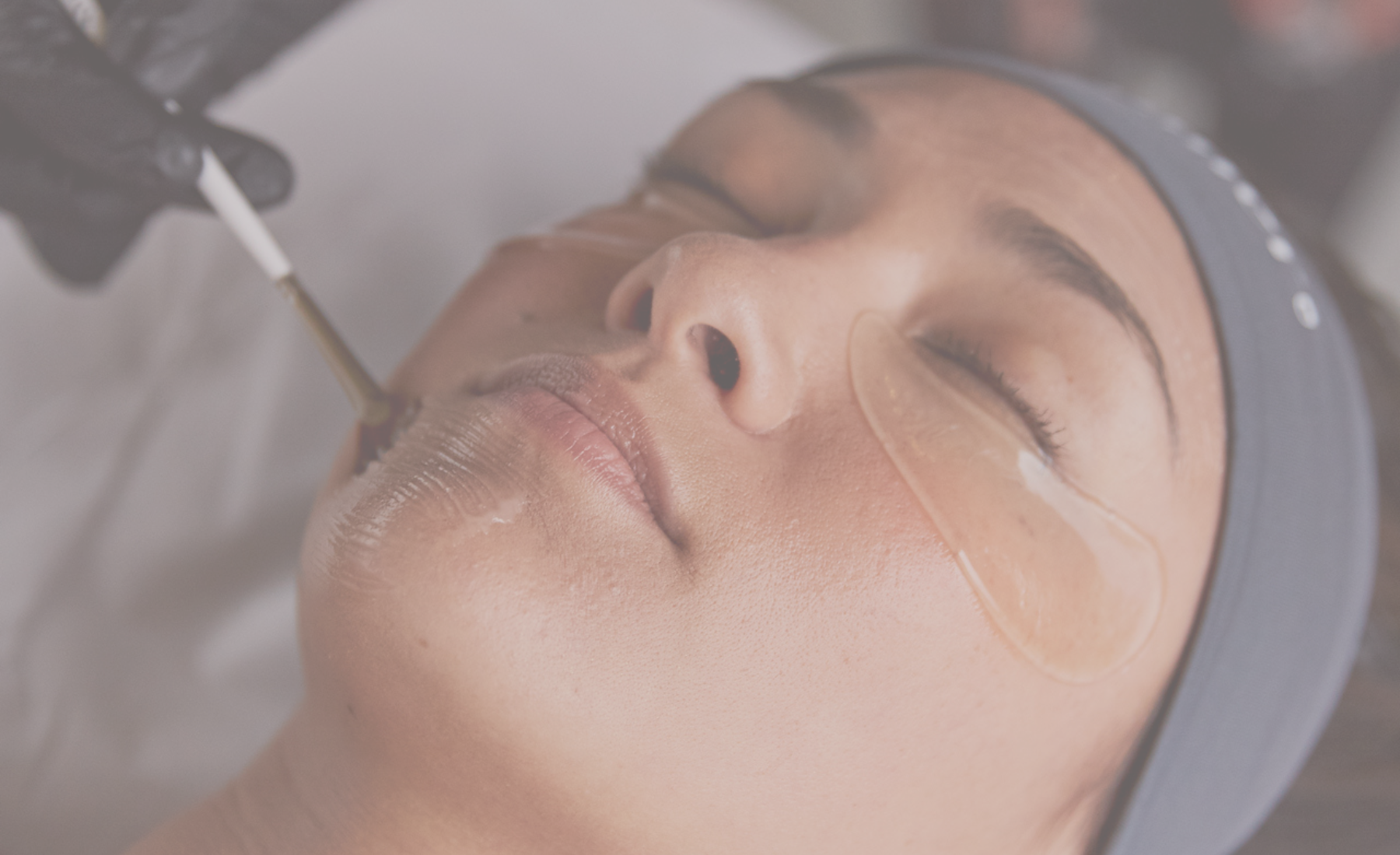 Alumier MD Professional Peel - The Skin Clinic